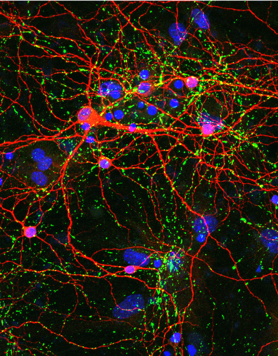 PhD in Integrative Physiology & Pharmacology - UGA VetMed